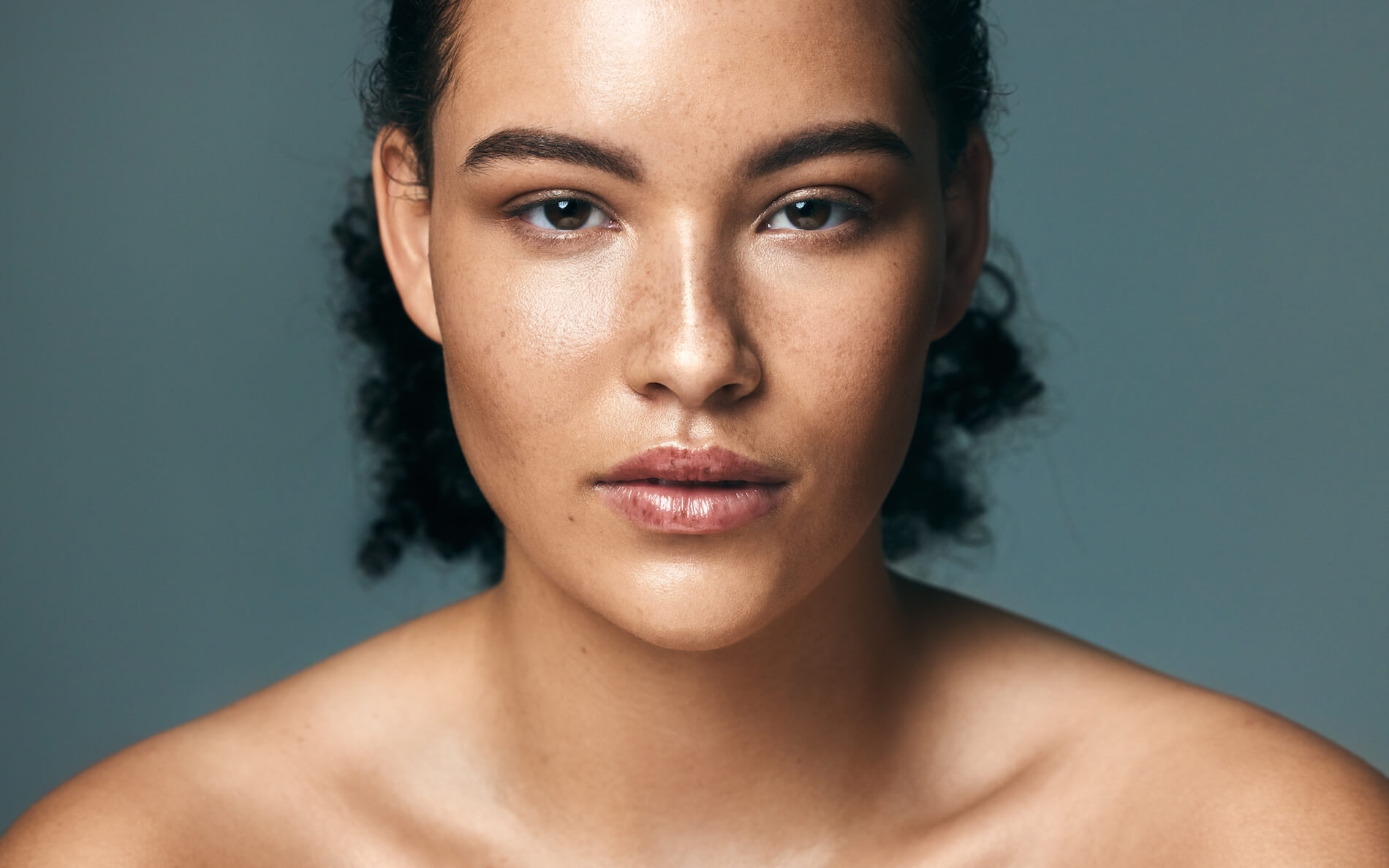 The Depigmenting Peel for Melasma: An Effective Treatment for ...